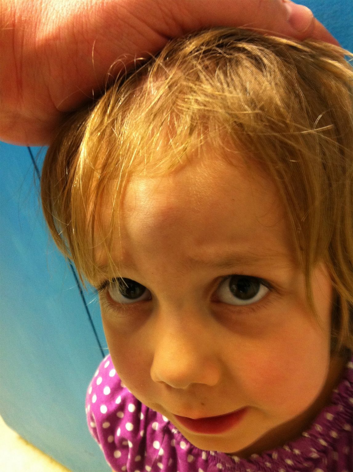 Hongos pueden estar detrás de los picores en la cabeza de tus niños ...